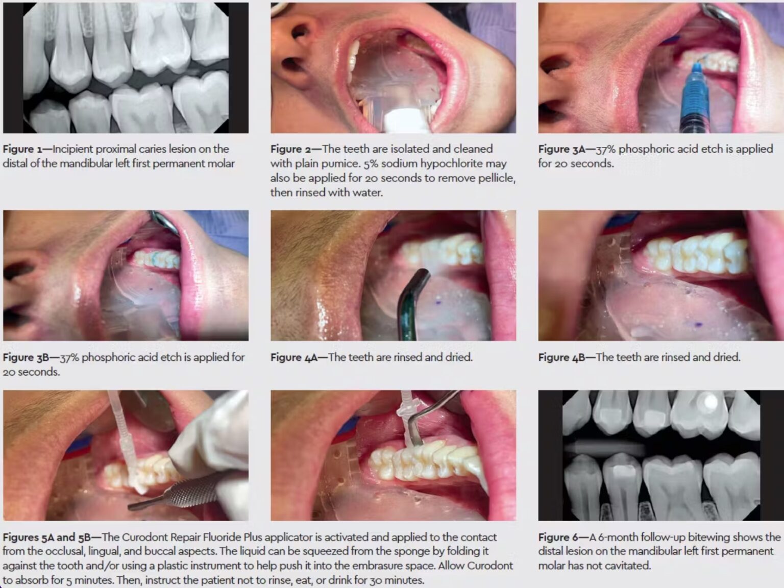 Check out the latest articles on Curodont by Dr. Jeanette MacLean ...
