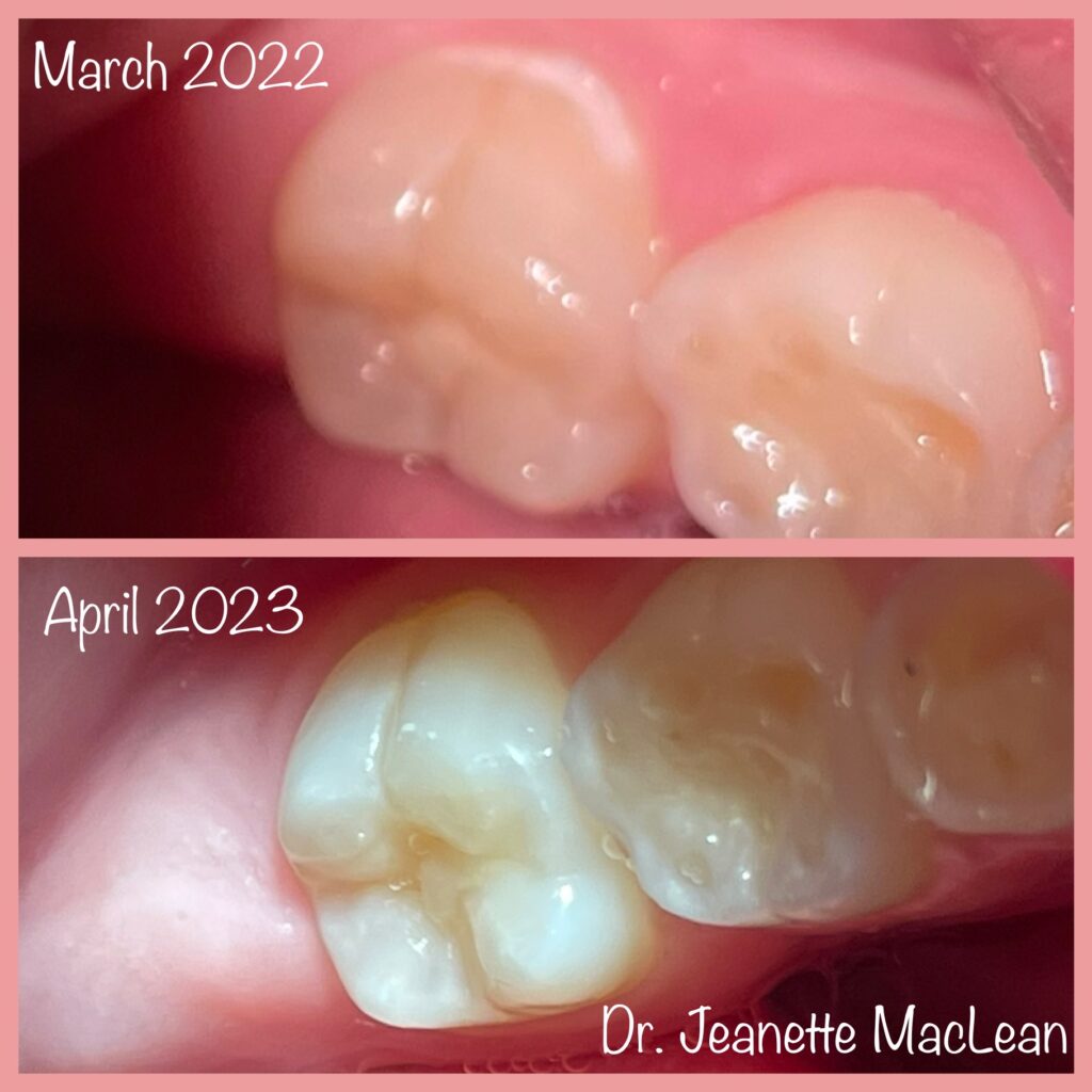 Curodont | Affiliated Children's Dental Specialists