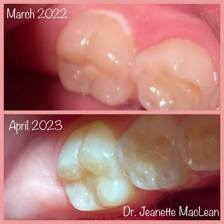 Curodont | Affiliated Children's Dental Specialists