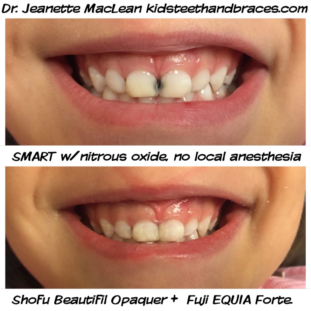 SDF | Affiliated Children's Dental Specialists